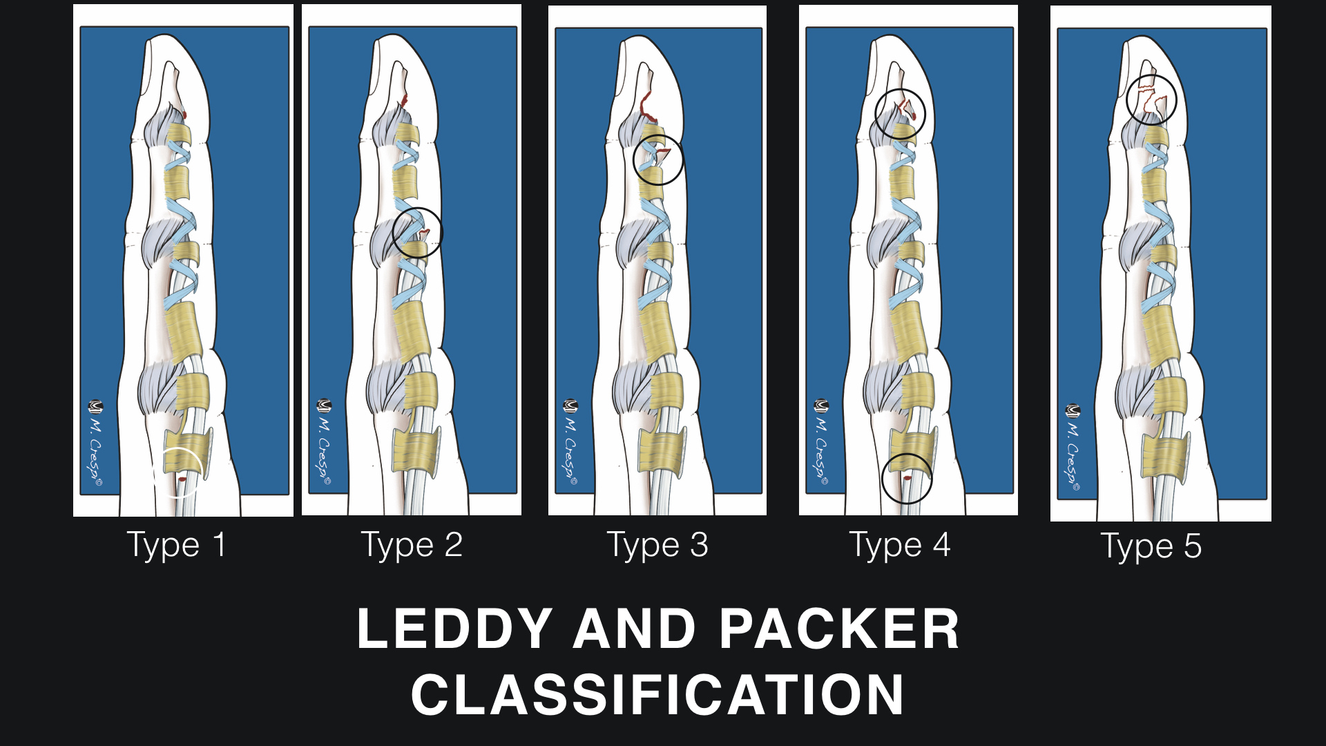 Ocad Msk Case Viewer